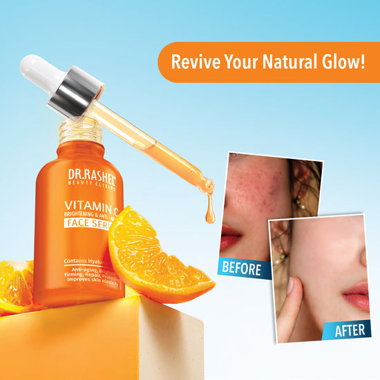 Buy Vitamin C Face Serum for Glowing Skin and Bright Radiance - Dr.Rashel
